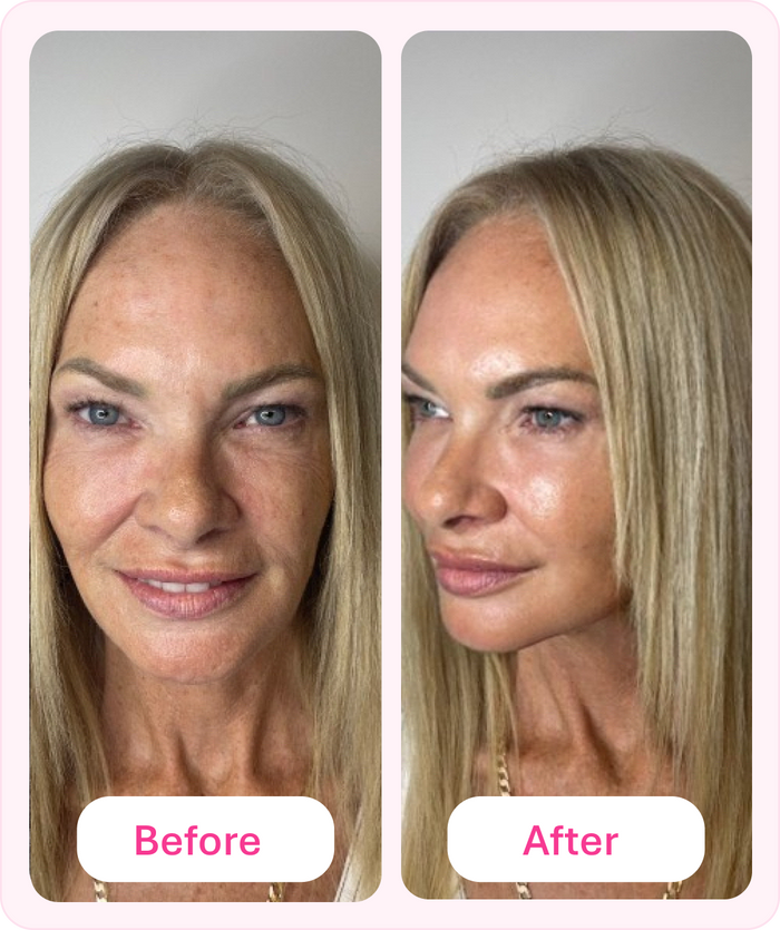 Dissolving Face Mask – K Republiq